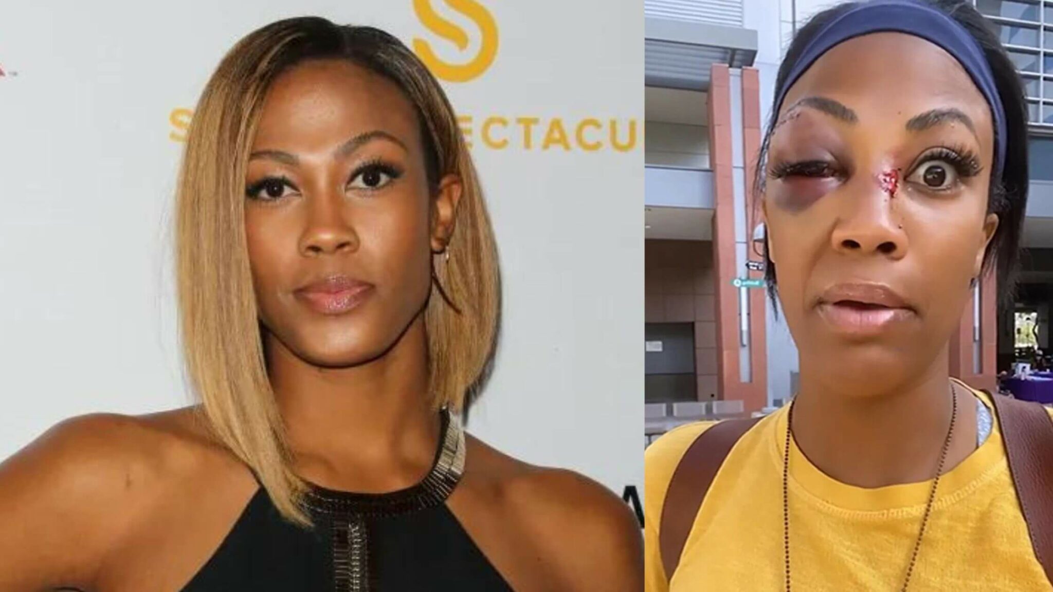 Former Olympian Kim Glass Allegedly Assaulted With A 'Metal Bolt'!!